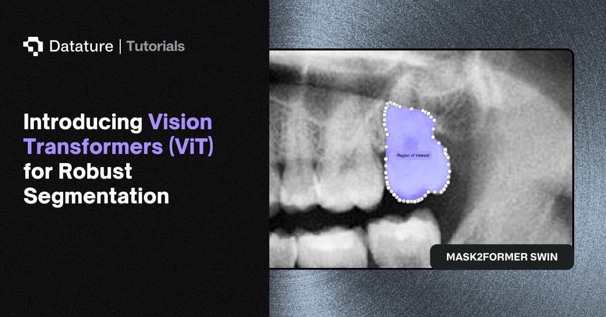 Introducing Vision Transformers for Robust Segmentation